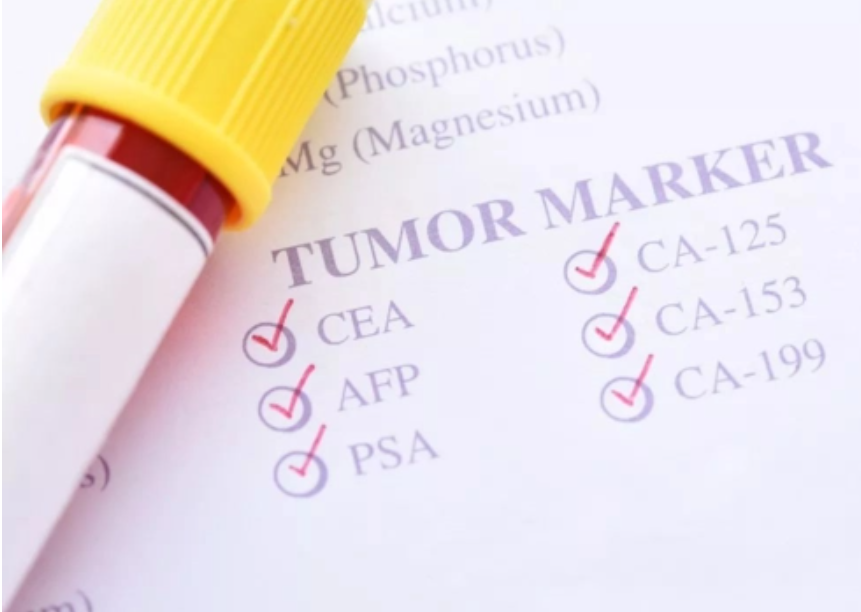 News - Elevated Tumor Markers – Does it Indicate Cancer?
